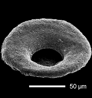 Arcellacean Identification Key