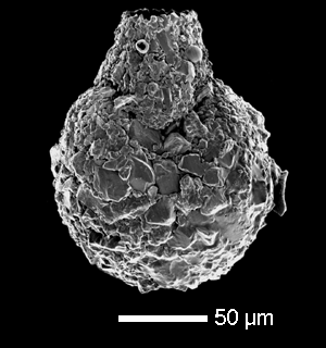 Arcellacean Identification Key