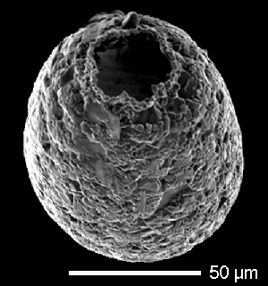 Arcellacean Identification Key