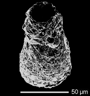 Arcellacean Identification Key