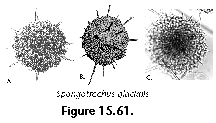 Order Spumellaria, Familiy Collosphaeridae: CLASSIFICATION AND ...
