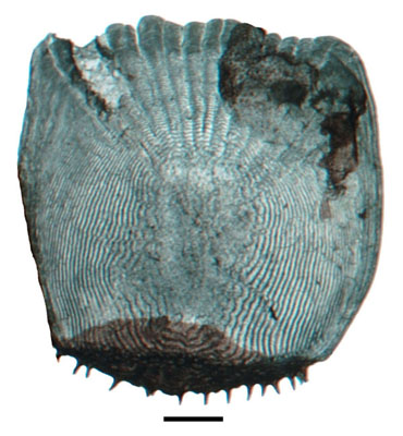 Figure 38.4. Sebastes paucispinis (BoccacioRockfish); scale bar = 1.0 mm.