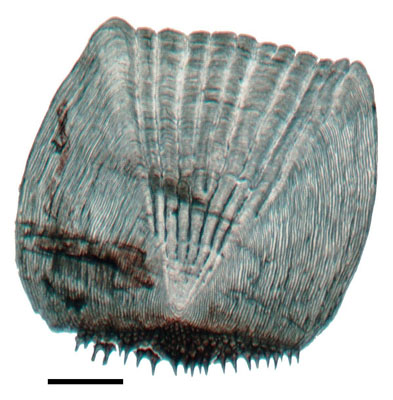 Figure 38.6. Sebastes paucispinis (BoccacioRockfish); scale bar = 1.0 mm.