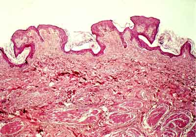 Prácticas de Histología. Tejido epitelial de revestimiento y glandular