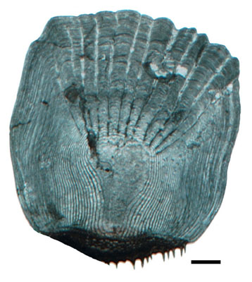 Figure 38.14. Sebastes paucispinis (BoccacioRockfish); scale bar = 1.0 mm.