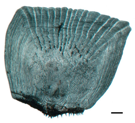 Figure 38.16. Sebastes paucispinis (BoccacioRockfish); scale bar = 1.0 mm.