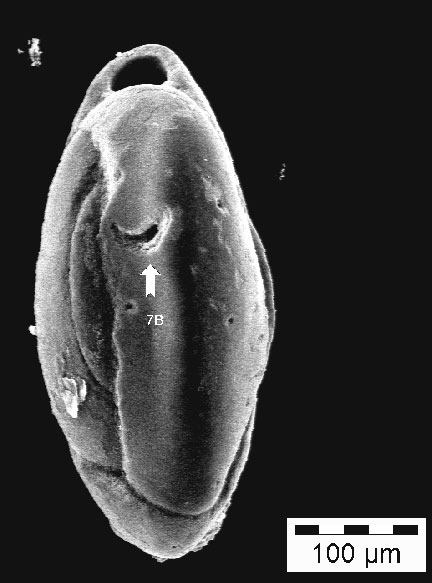 a location of specimen in foraminiferal test arrow b close up of same ...