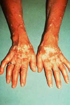 Universidad de Valencia